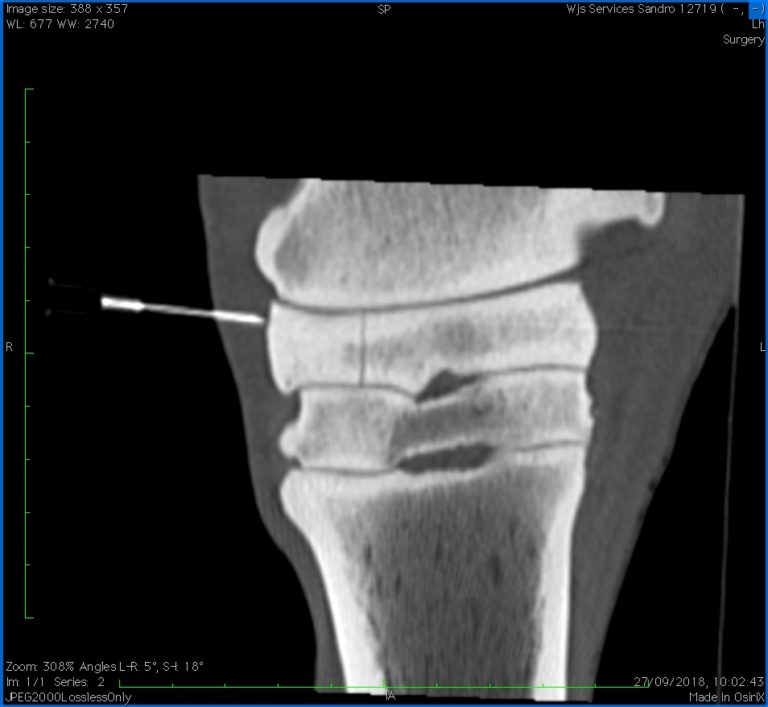 Mon cheval s'est cassé la jambe ! | Cheval Partenaire